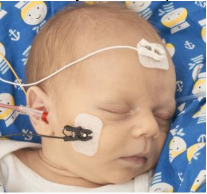 Sera™ | How to do Automated ABR | Interacoustics